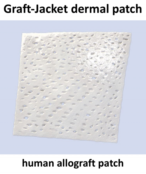 Fig 21. Dermal Patch – Cambridge Shoulder