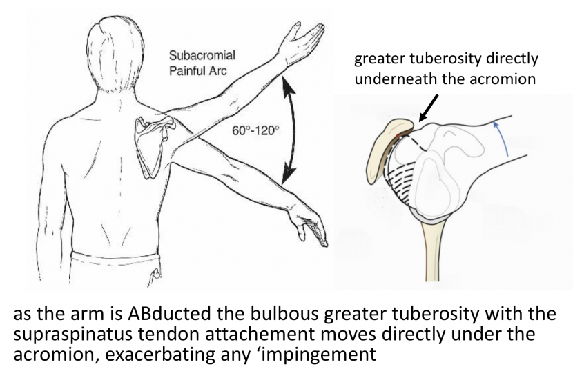 Fig 6. Painful Arc - Cambridge Shoulder