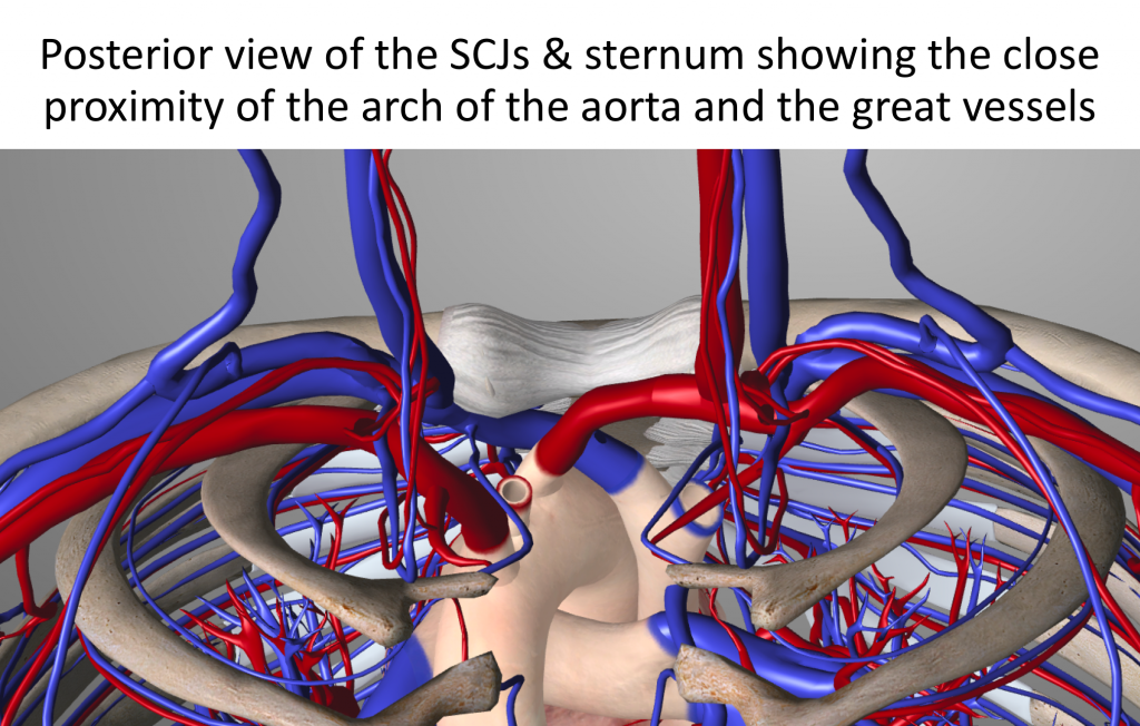 Fig 40. SCJ Post view - Cambridge Shoulder