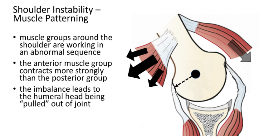 fig_10_muscle_patterning_instability_-_an_overactive_pe_ma_and_an ...